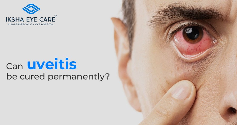 Can uveitis be cured permanently?